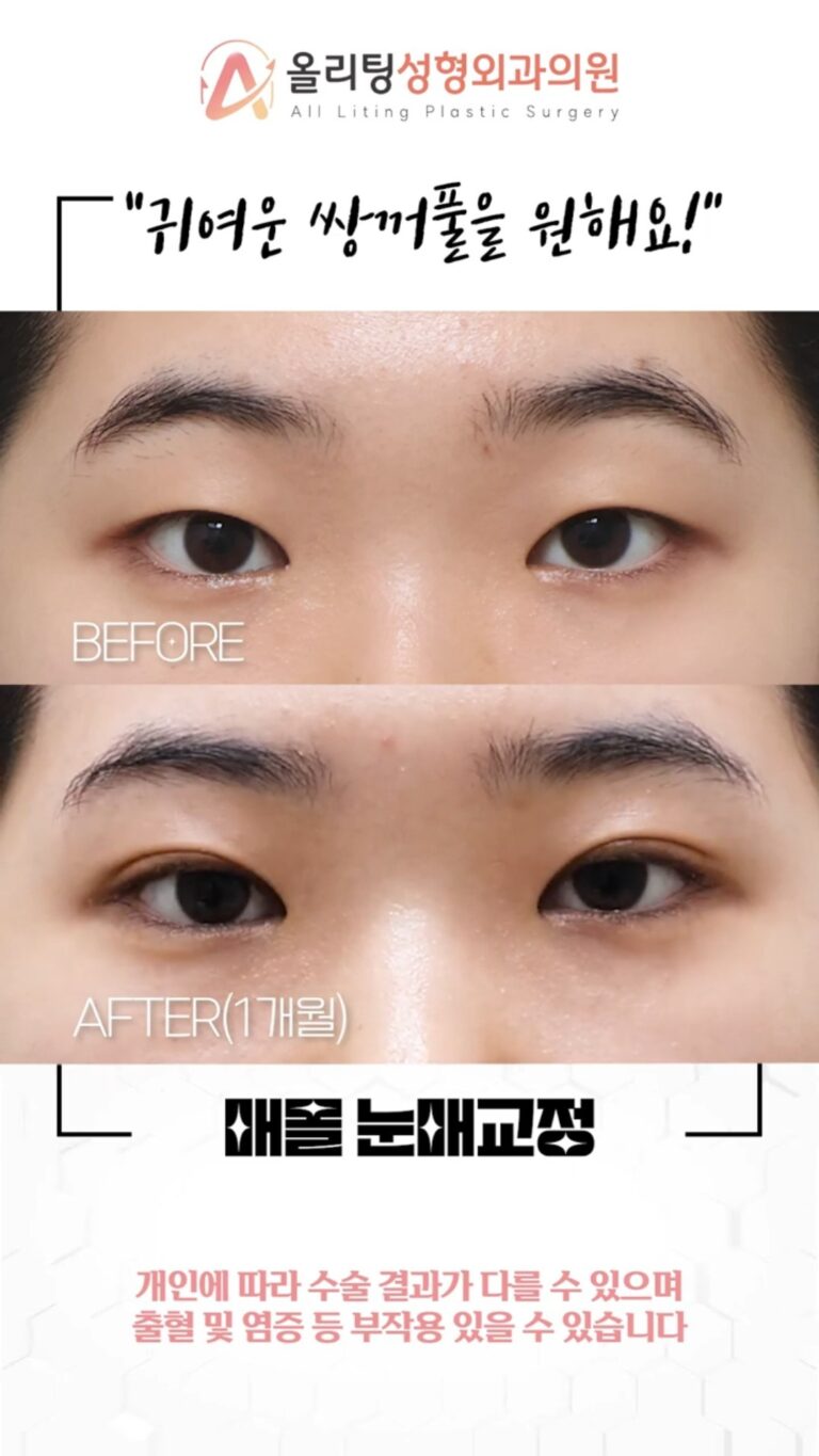 AllLiting Plastic surgery