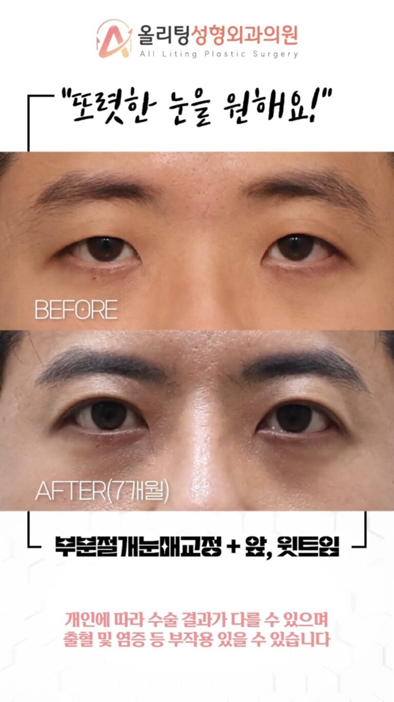 AllLiting Plastic surgery